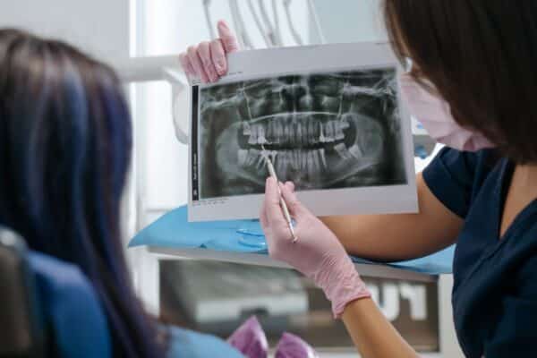 X-Rays (Analog) - 123Dentist Dental X-Rays in Canada | Analog Imaging ...
